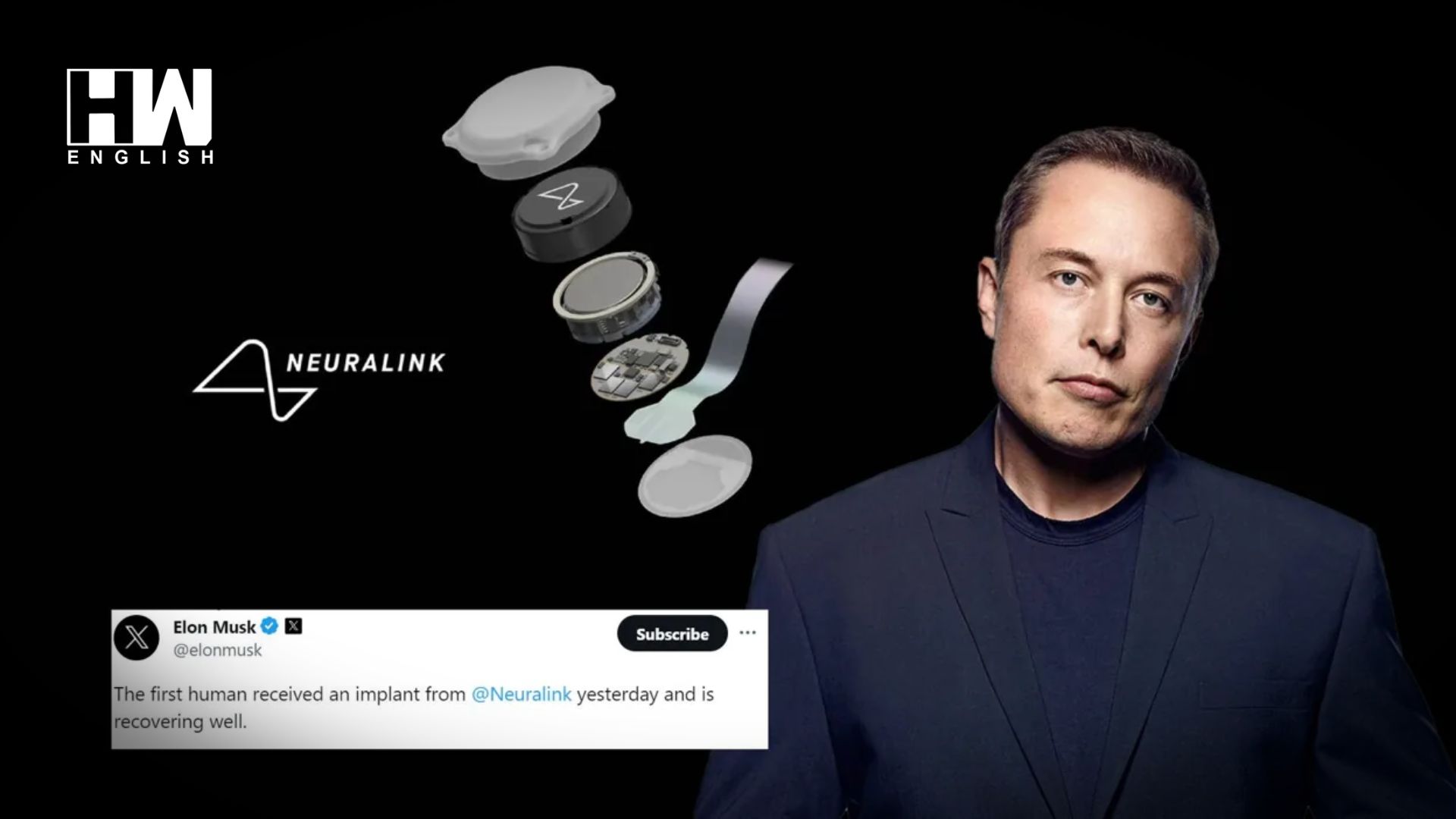Elon Musk Claims Successful Neuralink Wireless Brain Chip Implant - HW ...